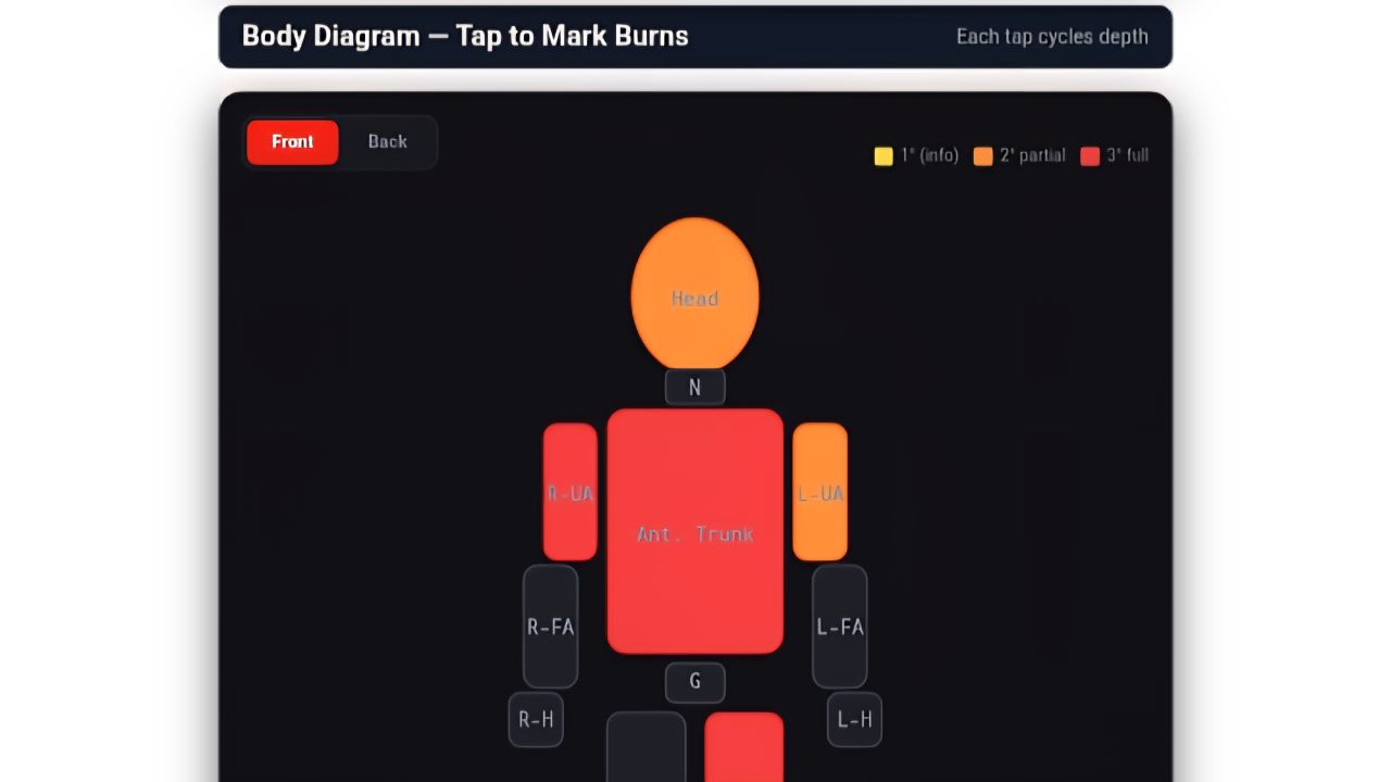 Burn TBSA Calculator — Rule of Nines + Parkland | AllFirefighter